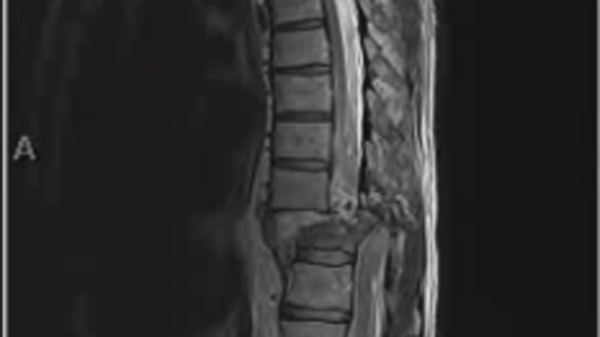 Nurse battling to recover from devastating fall - TimesChronicle.ca